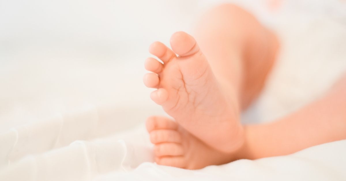 Pie plano flexible. Ortopedia y Pediatría. Tairon Díaz